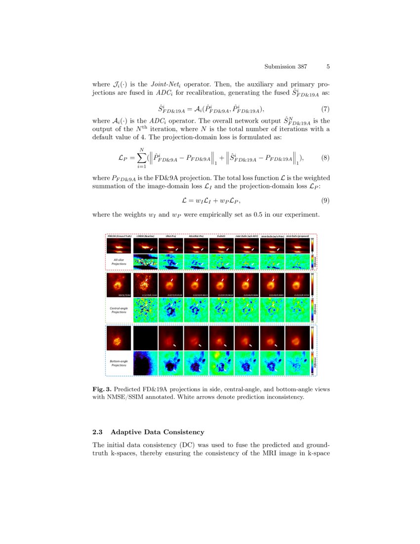 Joint Denoising And Few Angle Reconstruction For Low Dose Cardiac Spect