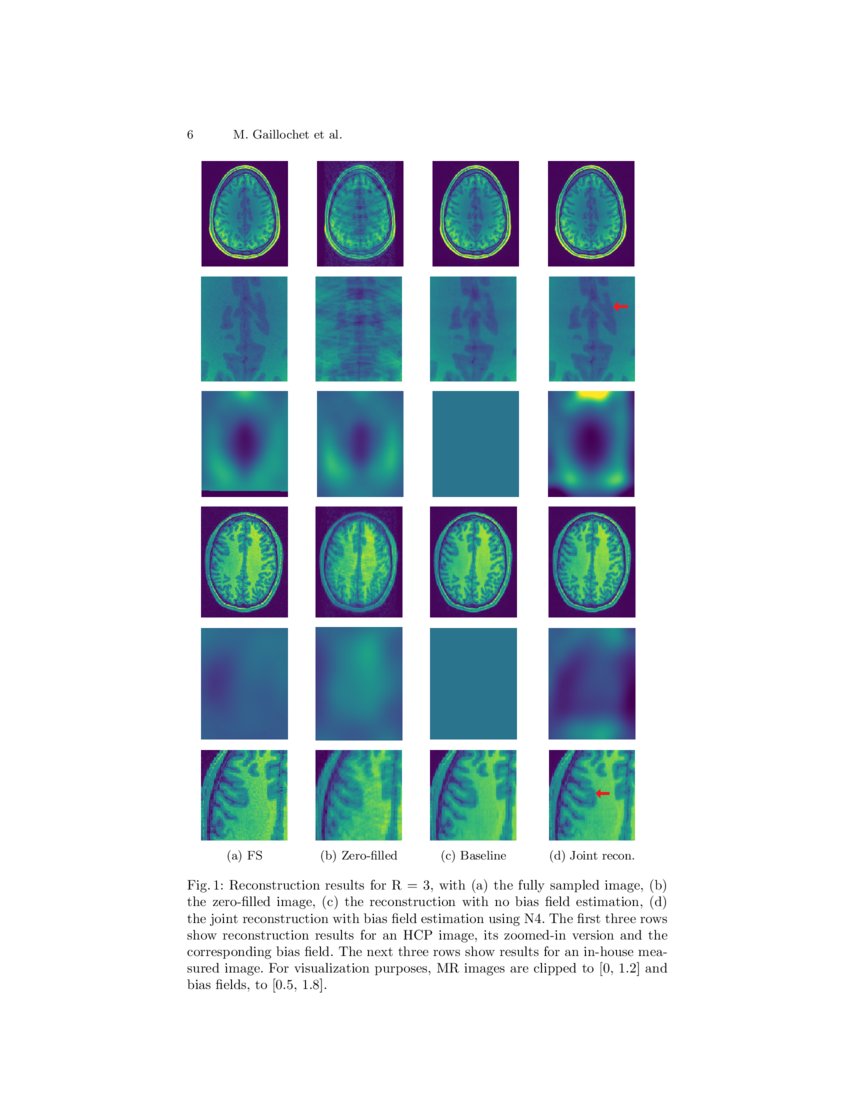 Joint reconstruction and bias field correction for undersampled MR imaging | DeepAI