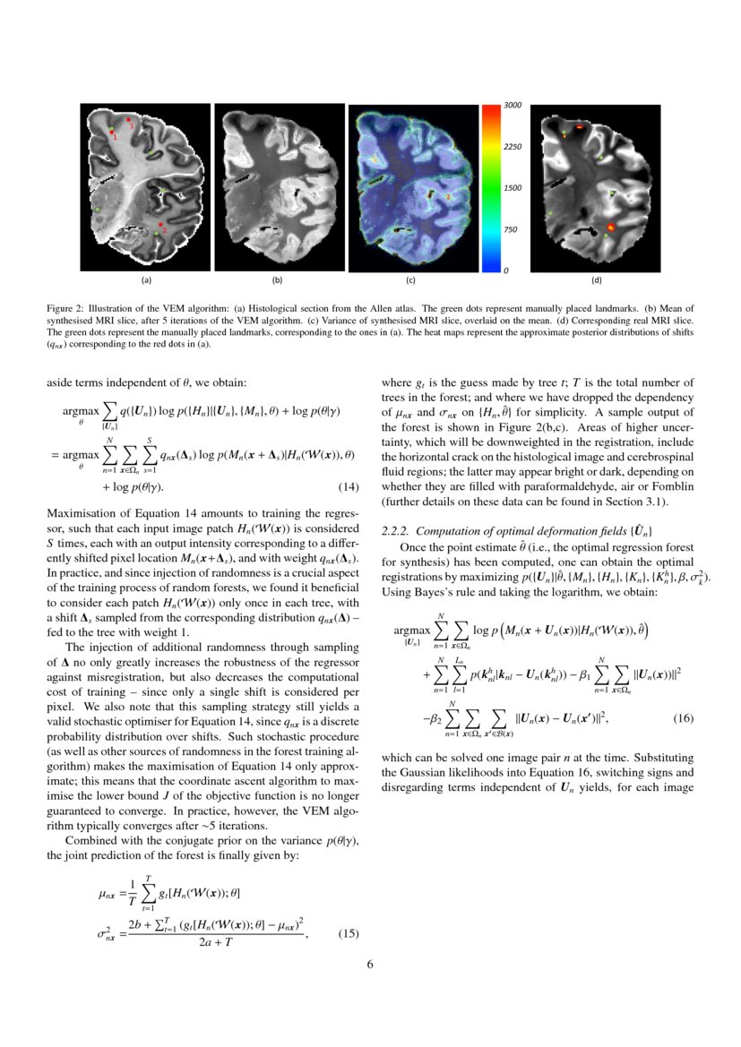 Joint registration and synthesis using a probabilistic model for alignment of MRI and ...