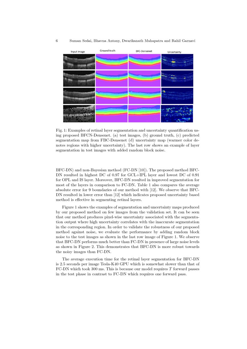 Joint Segmentation and Uncertainty Visualization of Retinal Layers in ...