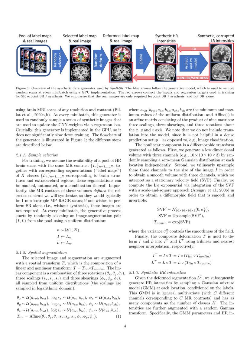 Joint super-resolution and synthesis of 1 mm isotropic MP-RAGE volumes ...