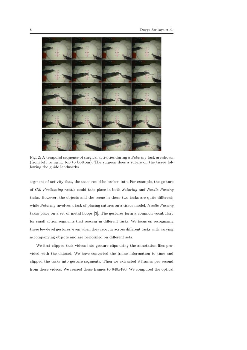 Joint Surgical Gesture and Task Classification with Multi-Task and Multimodal Learning | DeepAI