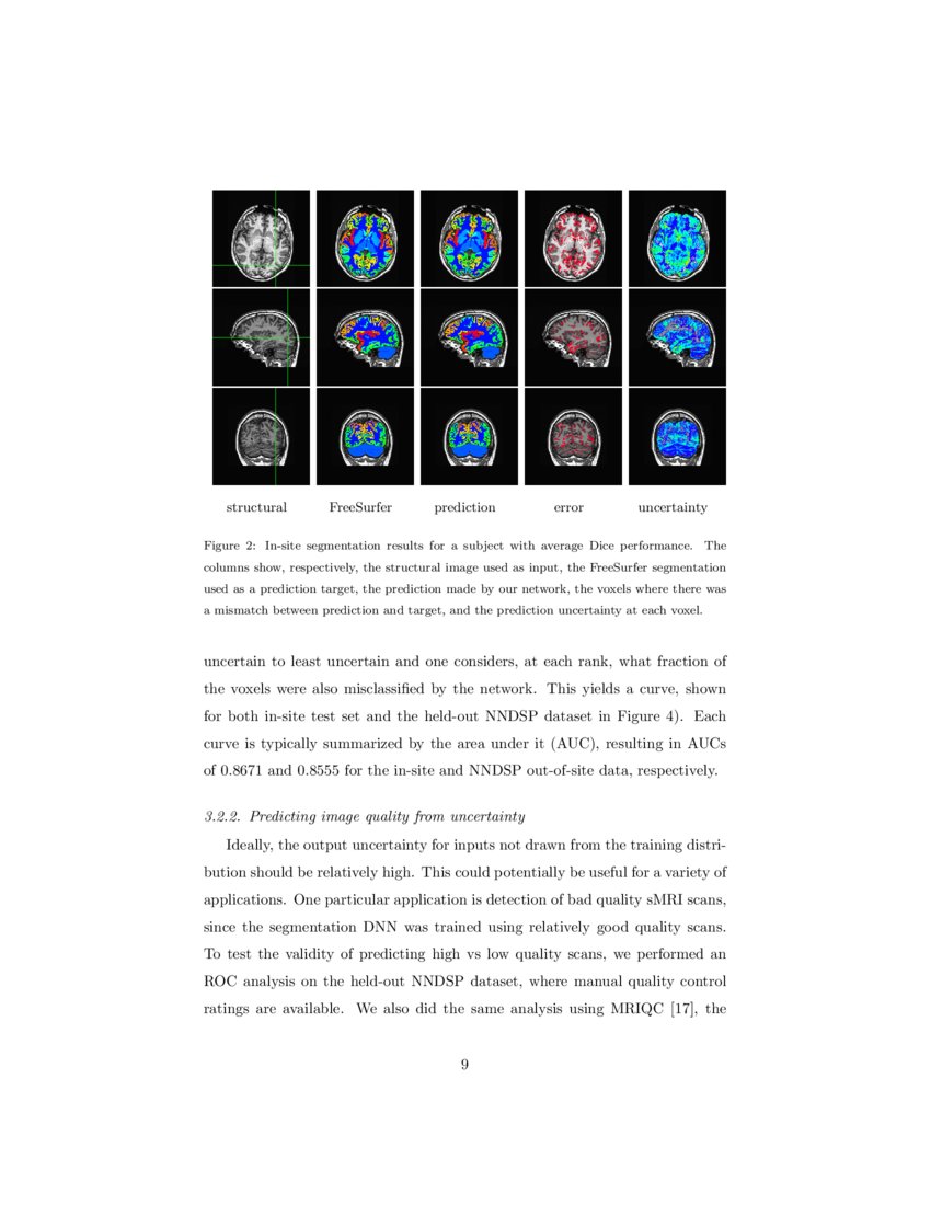 Knowing what you know in brain segmentation using deep neural networks ...