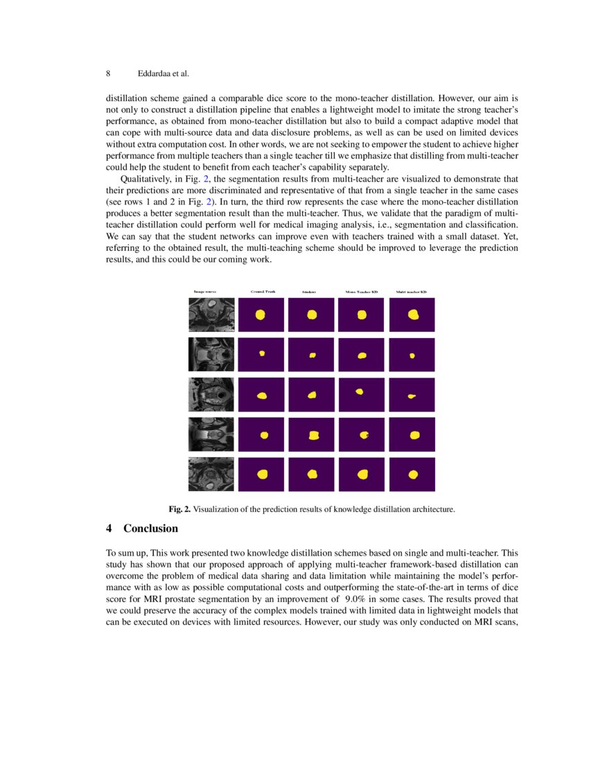 Knowledge Distillation For Adaptive Mri Prostate Segmentation Based On
