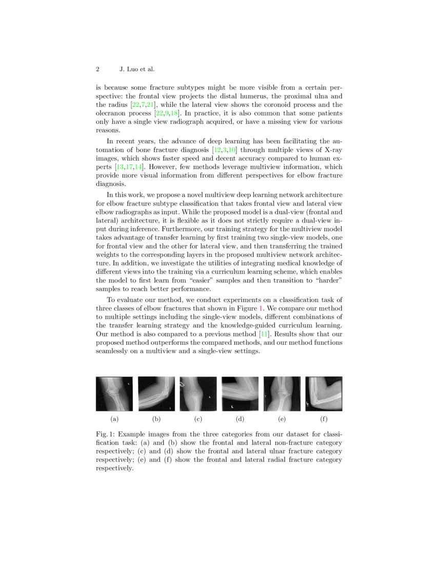 Knowledge-Guided Multiview Deep Curriculum Learning for Elbow Fracture ...