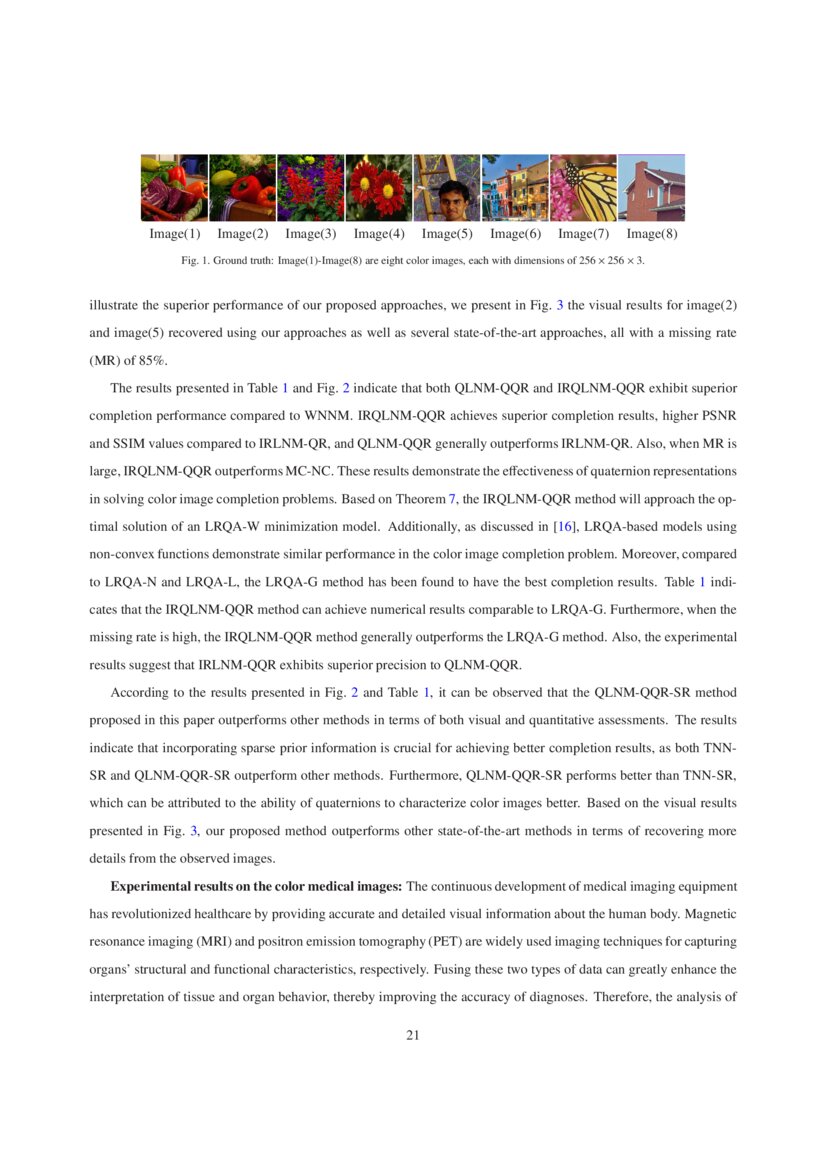 L21 Norm Regularized Quaternion Matrix Completion Using Sparse