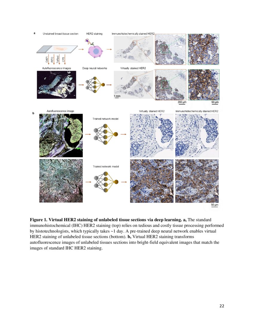 Label-free virtual HER2 immunohistochemical staining of breast tissue ...