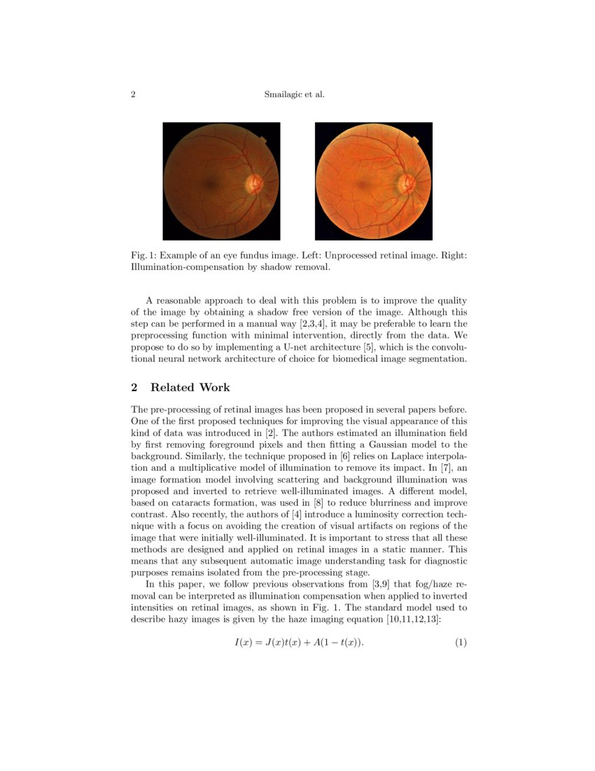 Learned Pre-Processing for Automatic Diabetic Retinopathy Detection on ...