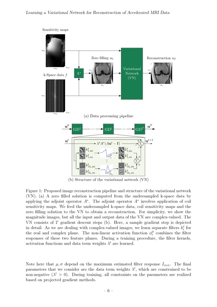 Learning a Variational Network for Reconstruction of Accelerated MRI ...
