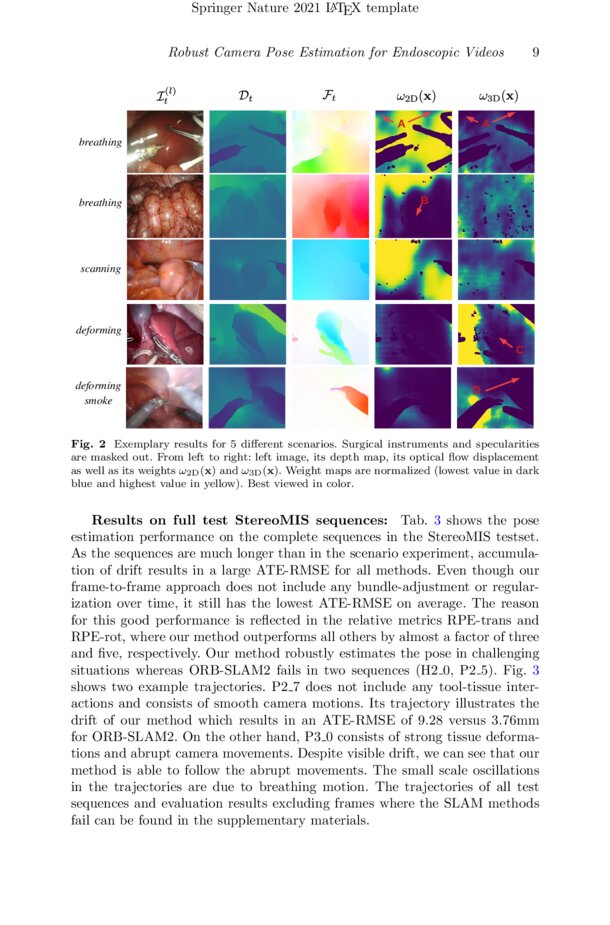 Learning How To Robustly Estimate Camera Pose in Endoscopic Videos | DeepAI