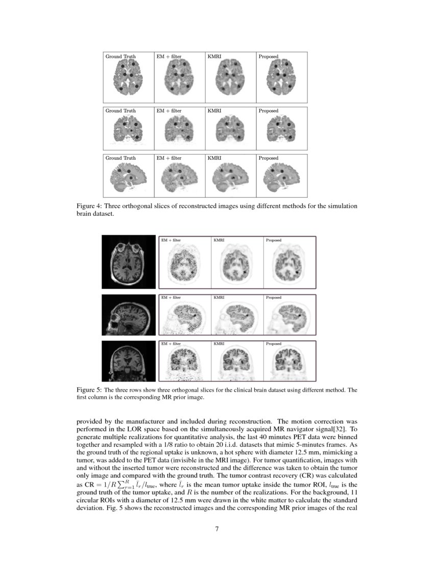 Learning Personalized Representation for Inverse Problems in Medical ...