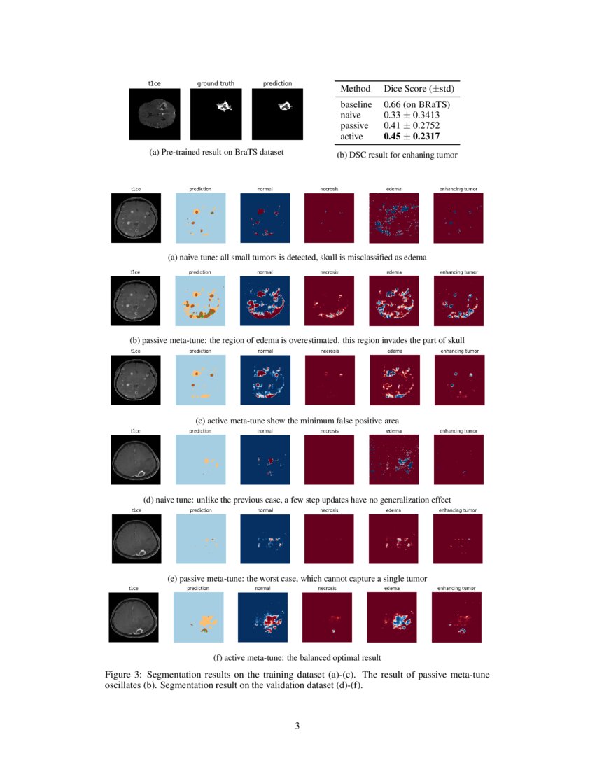 Learning to Learn Unlearned Feature for Brain Tumor Segmentation | DeepAI