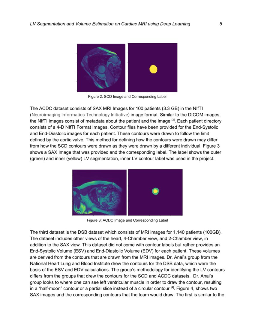 Left Ventricle Segmentation And Volume Estimation On Cardiac Mri Using