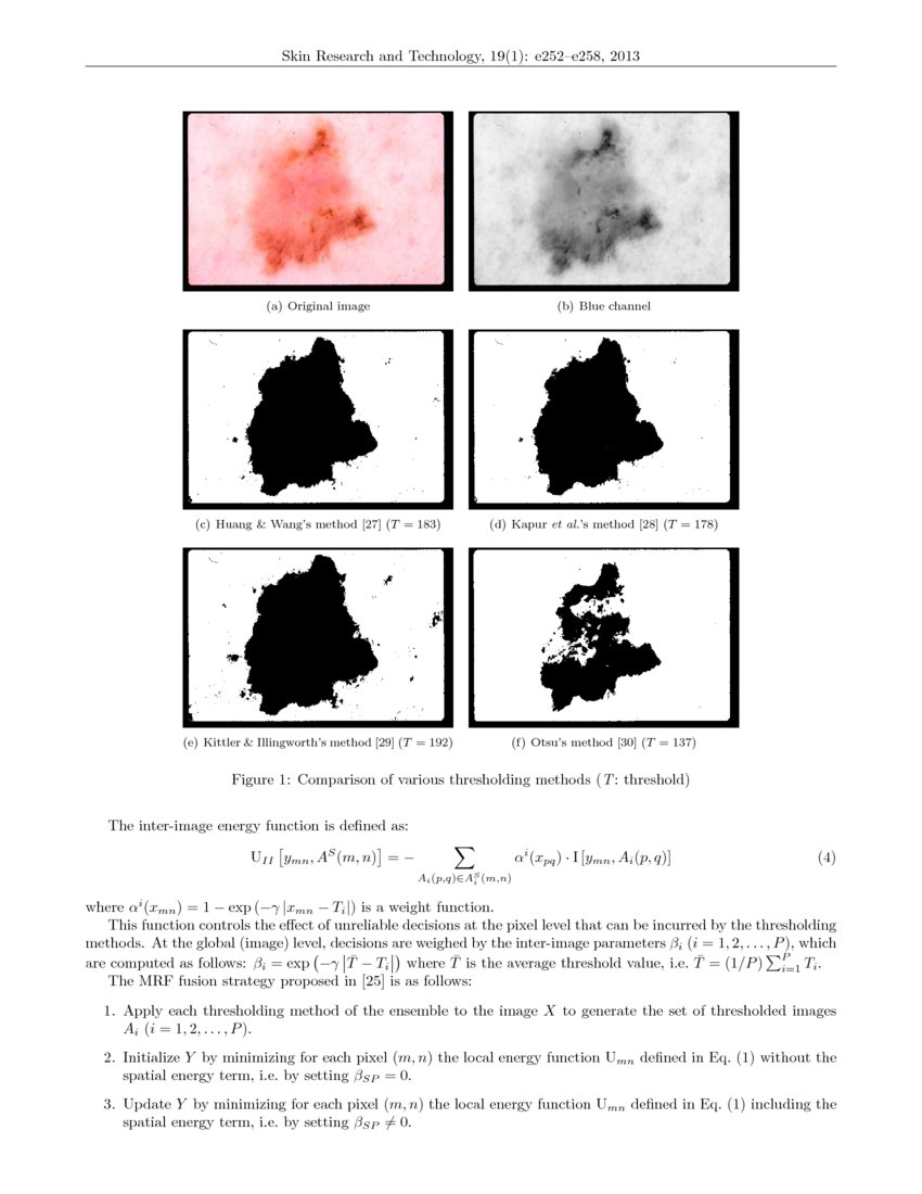 Lesion Border Detection In Dermoscopy Images Using Ensembles Of Thresholding Methods Deepai