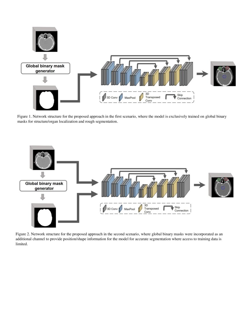 Leveraging Global Binary Masks for Structure Segmentation in Medical ...