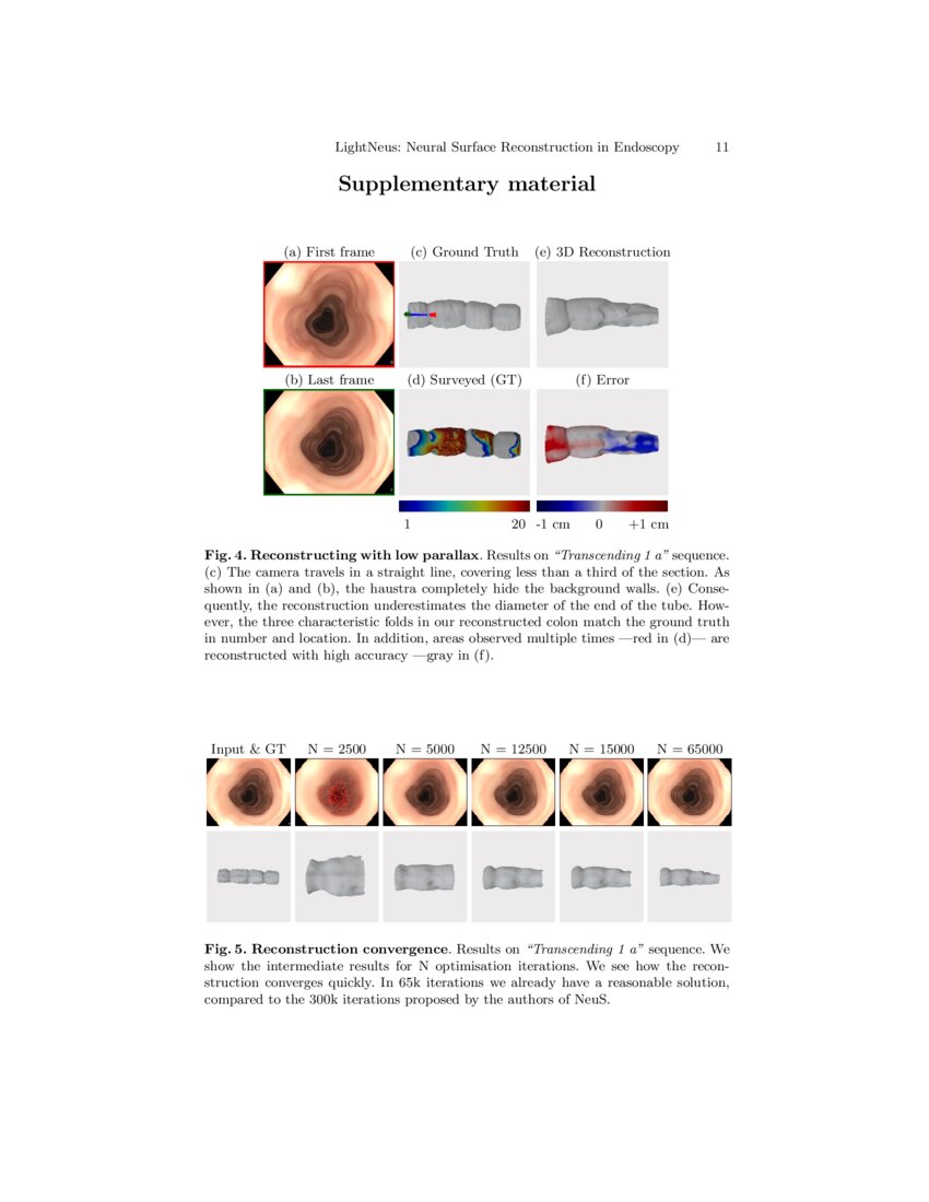 LightNeuS: Neural Surface Reconstruction in Endoscopy using ...