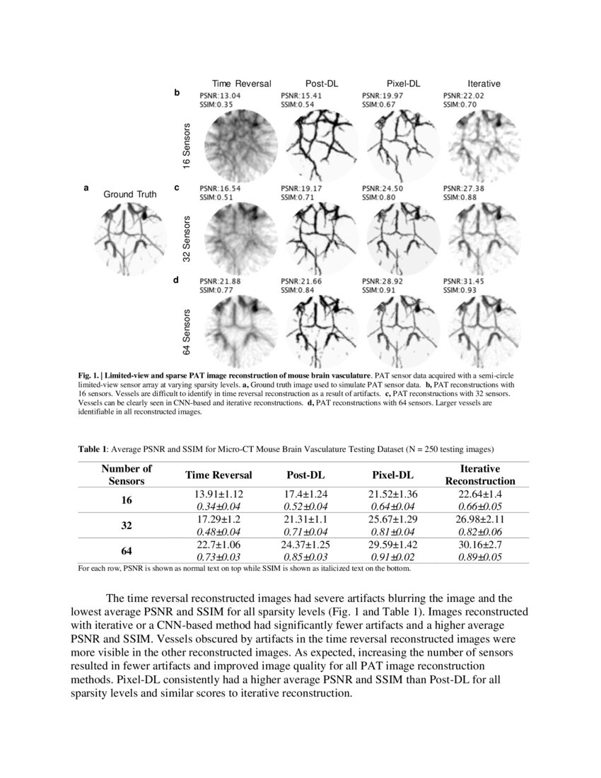 Limited View and Sparse Photoacoustic Tomography for Neuroimaging with Deep Learning | DeepAI