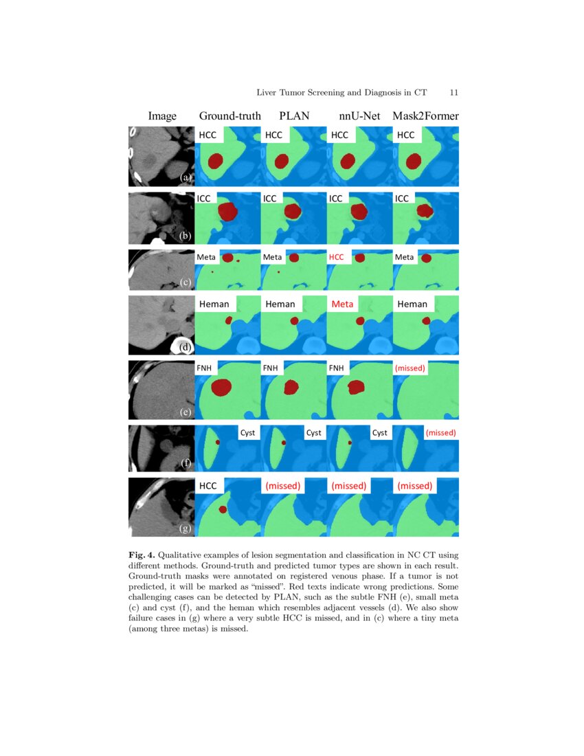 Liver Tumor Screening and Diagnosis in CT with Pixel-Lesion-Patient ...