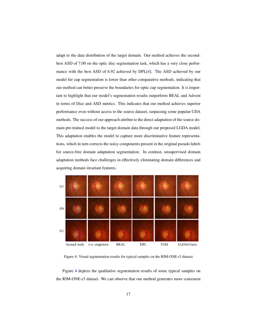 Local Global Pseudo Label Correction For Source Free Domain Adaptive Medical Image Segmentation 5712