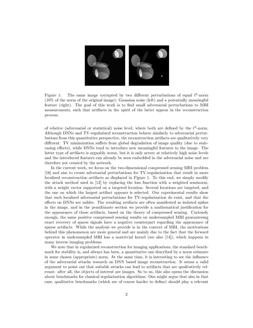Localized adversarial artifacts for compressed sensing MRI | DeepAI