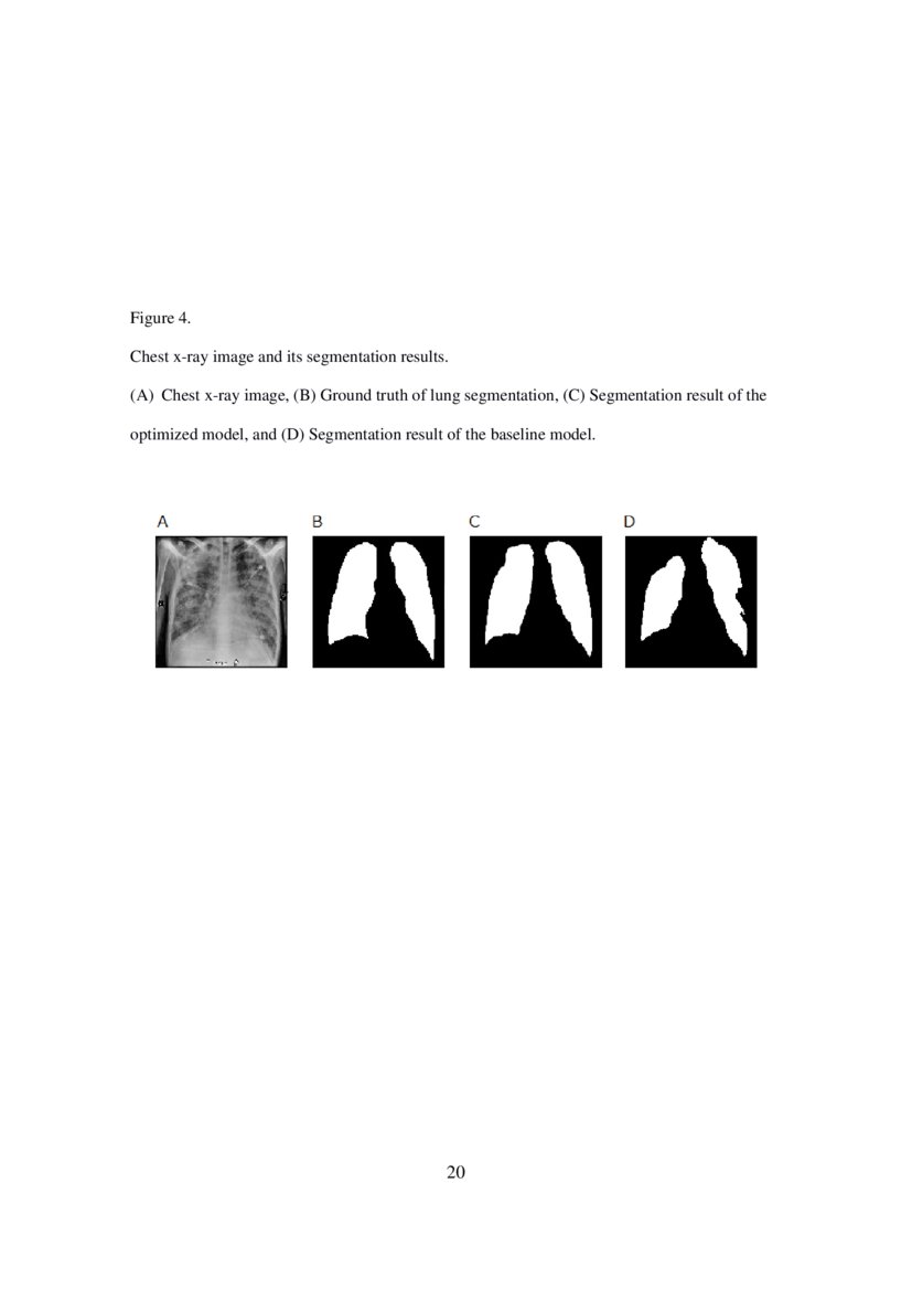 Lung Segmentation On Chest X Ray Images In Patients With Severe Abnormal Findings Using Deep