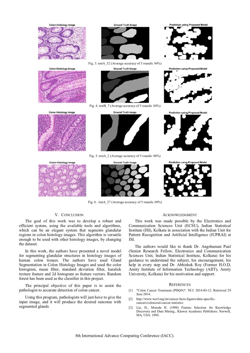 Machine learning approach for segmenting glands in colon histology ...