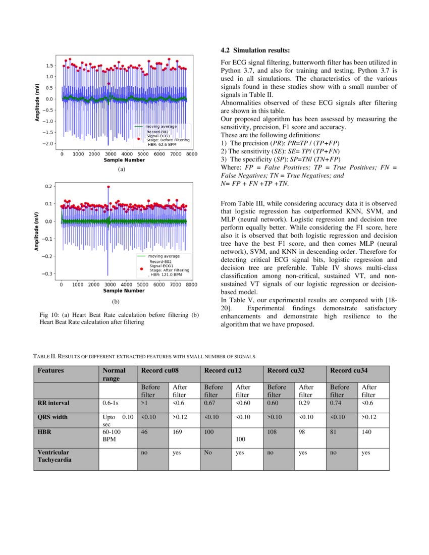 Machine Learning-based Efficient Ventricular Tachycardia Detection ...