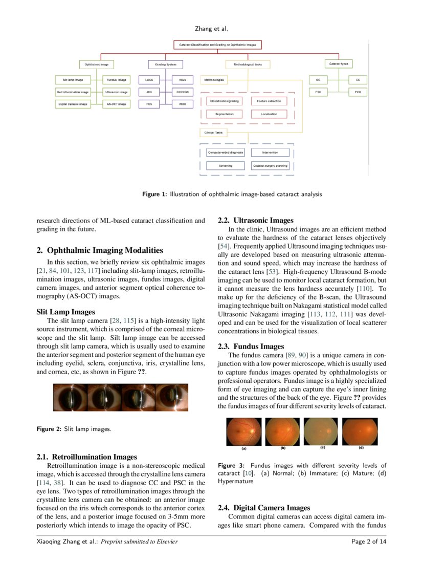 Machine Learning For Cataract Classification And Grading On Ophthalmic