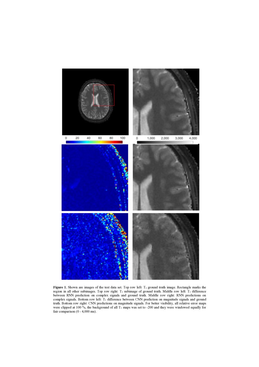 Magnetic Resonance Fingerprinting Reconstruction Using Recurrent Neural ...