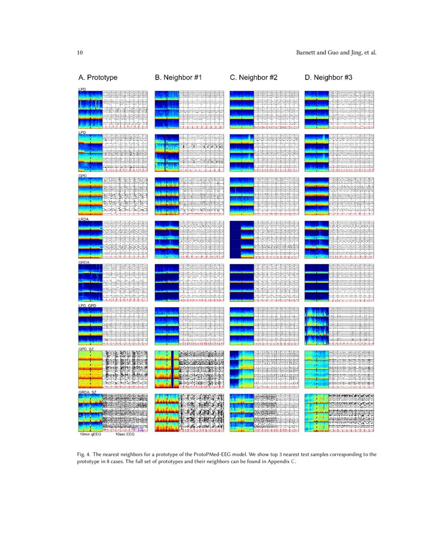 Mapping the Ictal-Interictal-Injury Continuum Using Interpretable Machine Learning | DeepAI