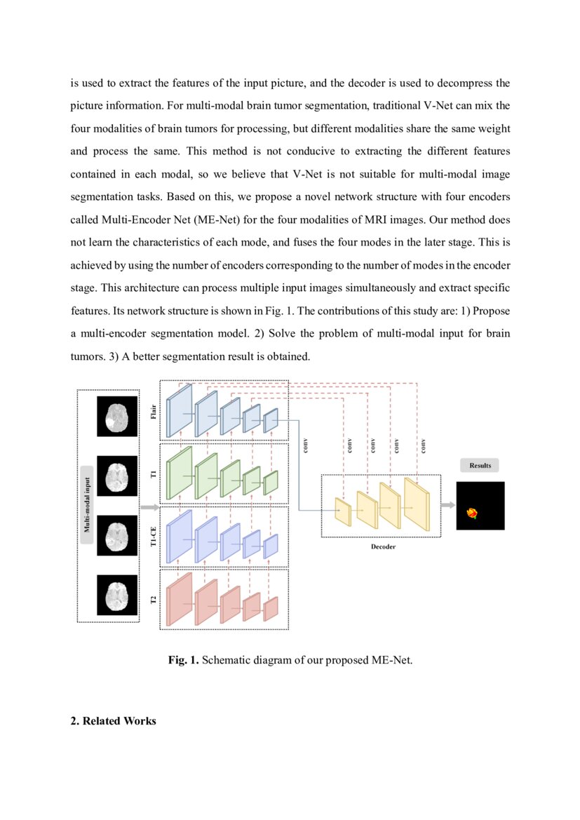 ME-Net: Multi-Encoder Net Framework for Brain Tumor Segmentation | DeepAI ME-Net: Multi-Encoder Net Framework for Brain Tumor Segmentation | DeepAI