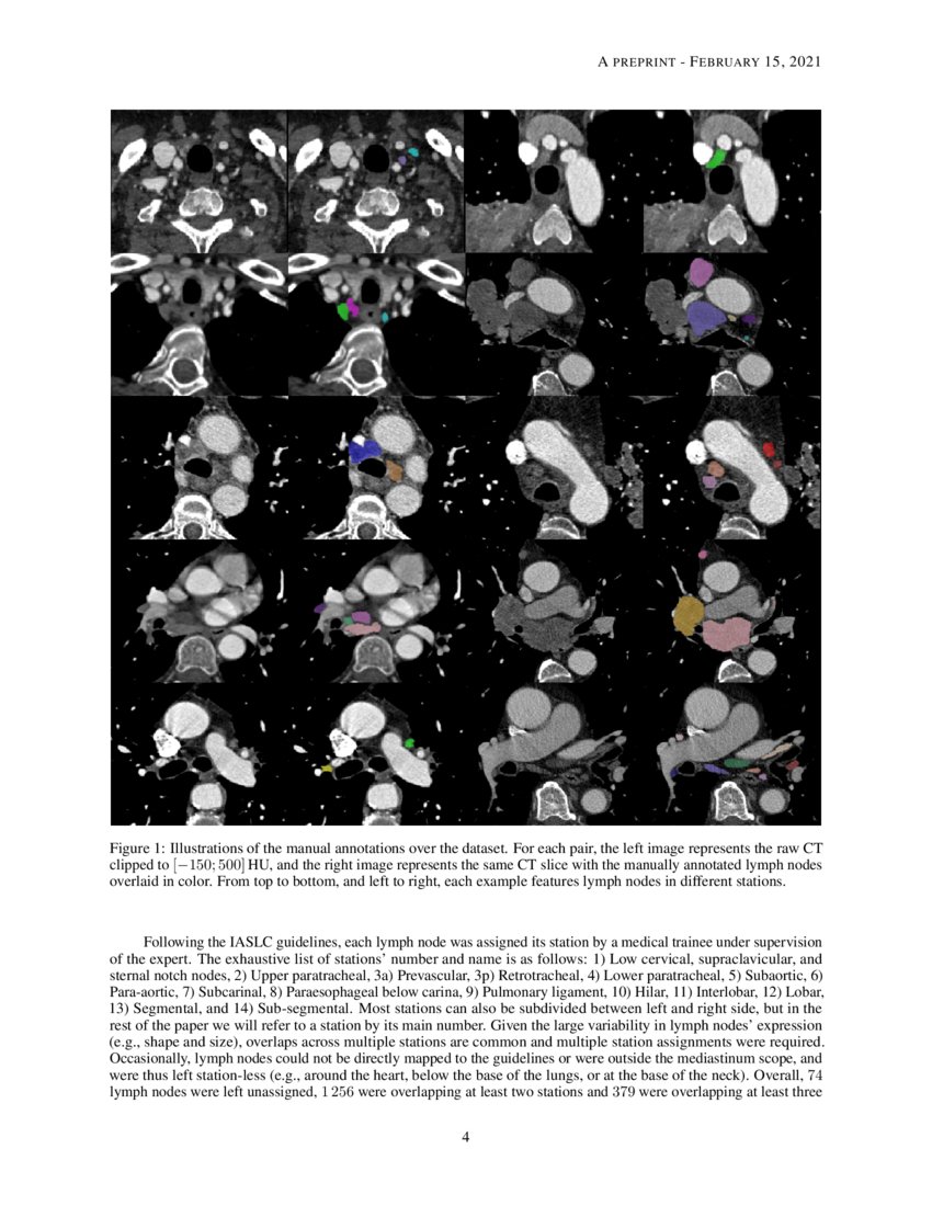 Mediastinal lymph nodes segmentation using 3D convolutional neural network ensembles and ...