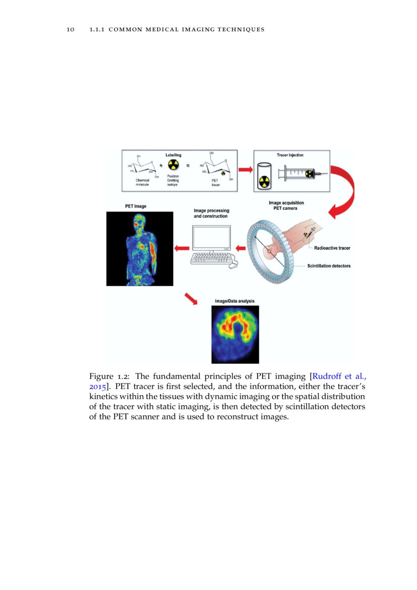 Medical Image Segmentation with Belief Function Theory and Deep ...