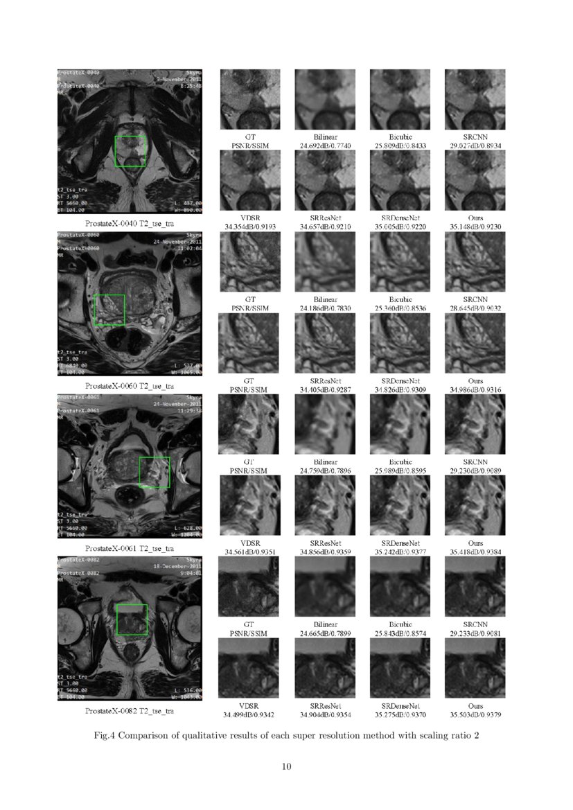 Medical image super-resolution method based on dense blended attention network | DeepAI
