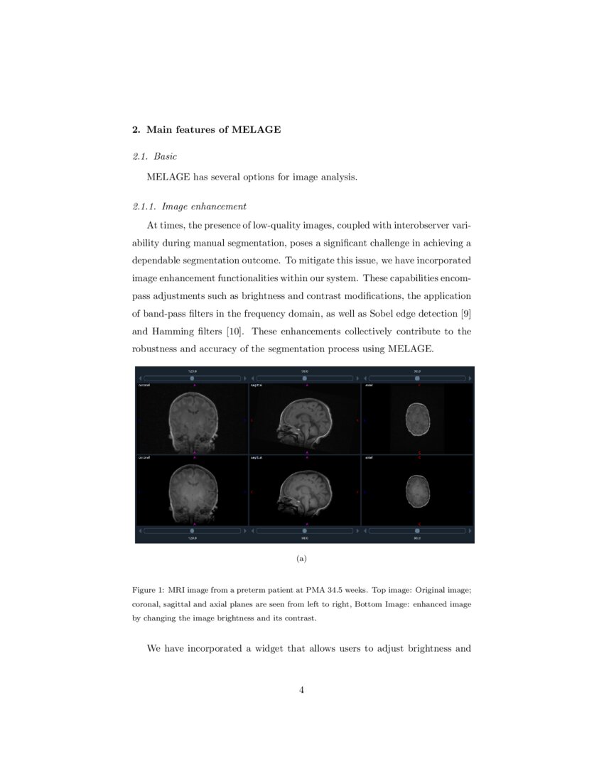 MELAGE: A purely python based Neuroimaging software (Neonatal) | DeepAI