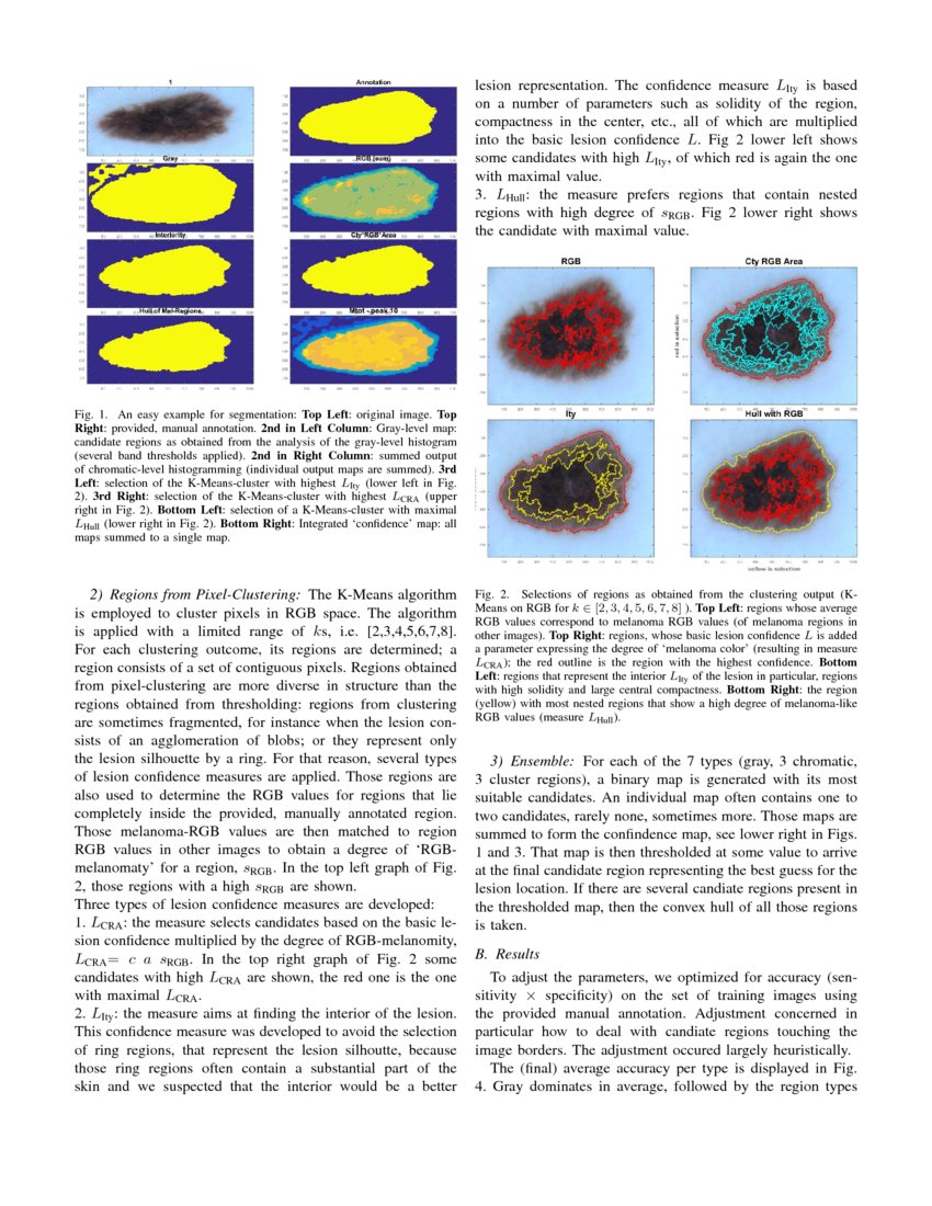 Melanoma Recognition With An Ensemble Of Techniques For Segmentation And A Structural Analysis