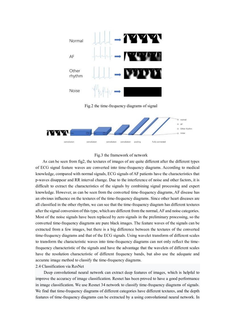 Method Of Diagnosing Heart Disease Based On Deep Learning Ecg Signal Deepai