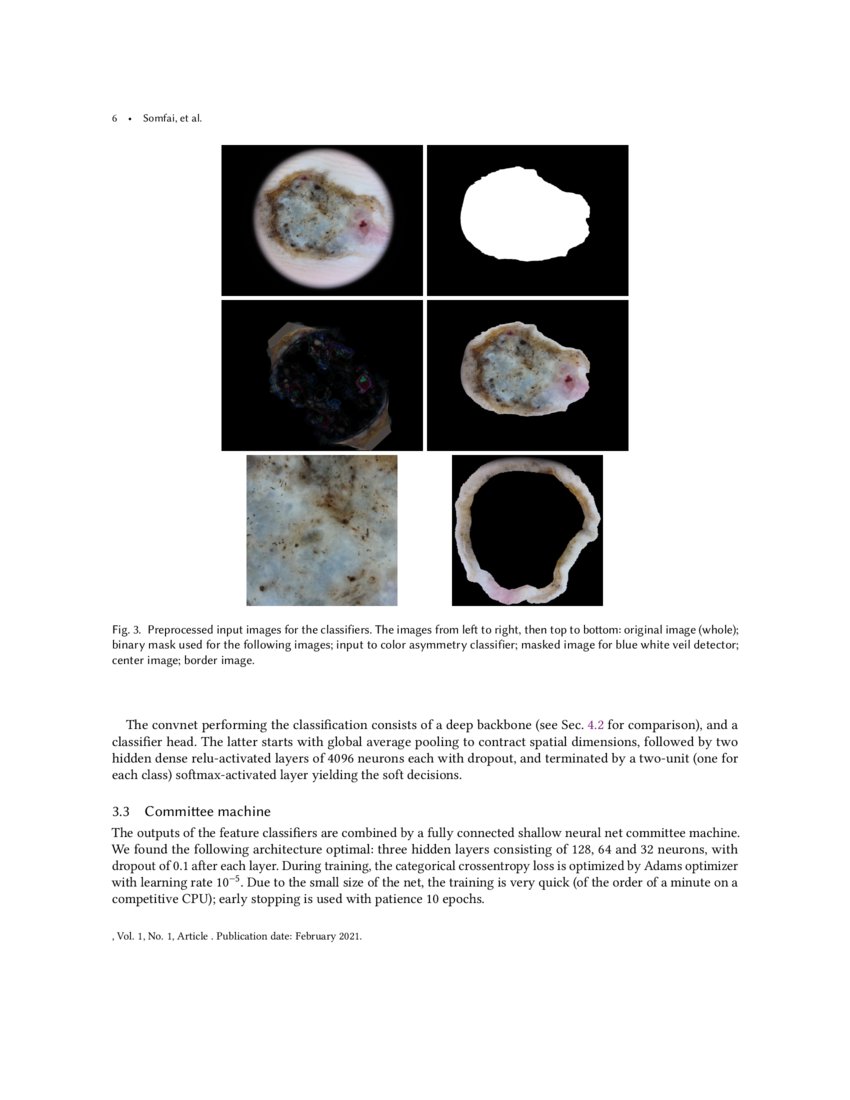 Minimizing False Negative Rate In Melanoma Detection And Providing N minimizing-false-negative-rate-in-melanoma-detection-and-providing-n