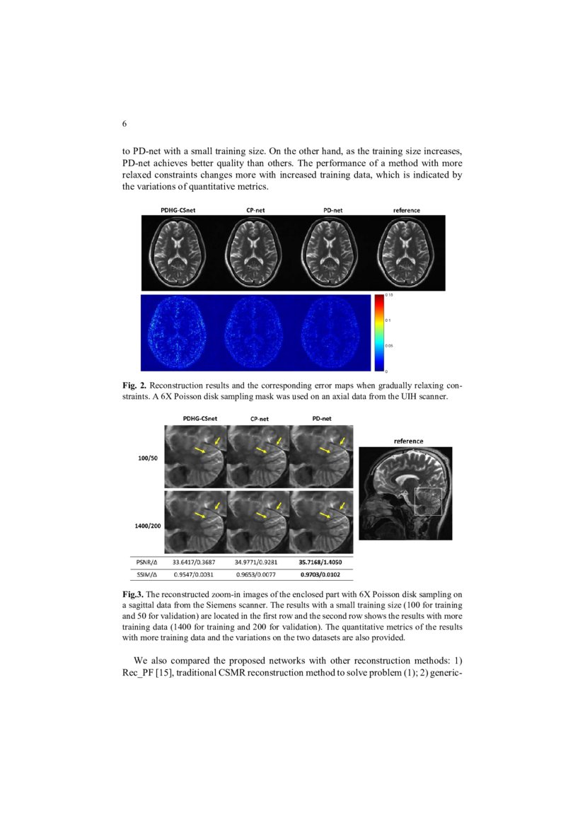 Model Learning: Primal Dual Networks for Fast MR imaging | DeepAI
