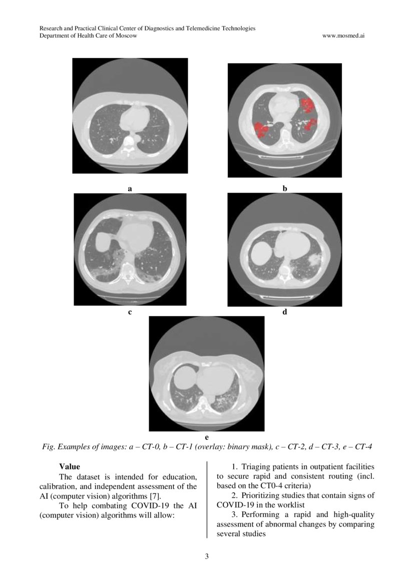 MosMedData: Chest CT Scans With COVID-19 Related Findings Dataset | DeepAI