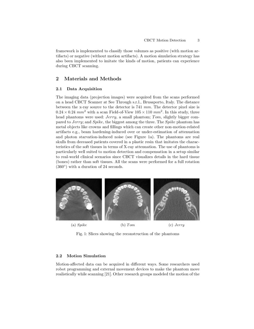 Motion Artifacts Detection In Short Scan Dental Cbct Reconstructions Deepai