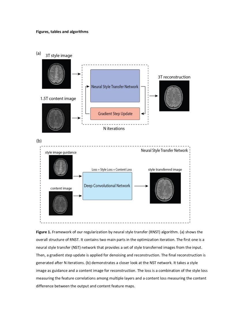 Mri Field Transfer Reconstruction With Limited Data Regularization By