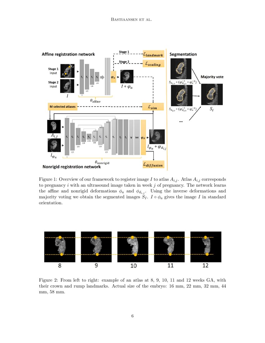 Multi-Atlas Segmentation and Spatial Alignment of the Human Embryo in ...