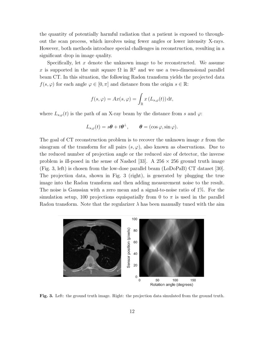 Multi-code deep image prior based plug-and-play ADMM for image denoising and CT reconstruction ...