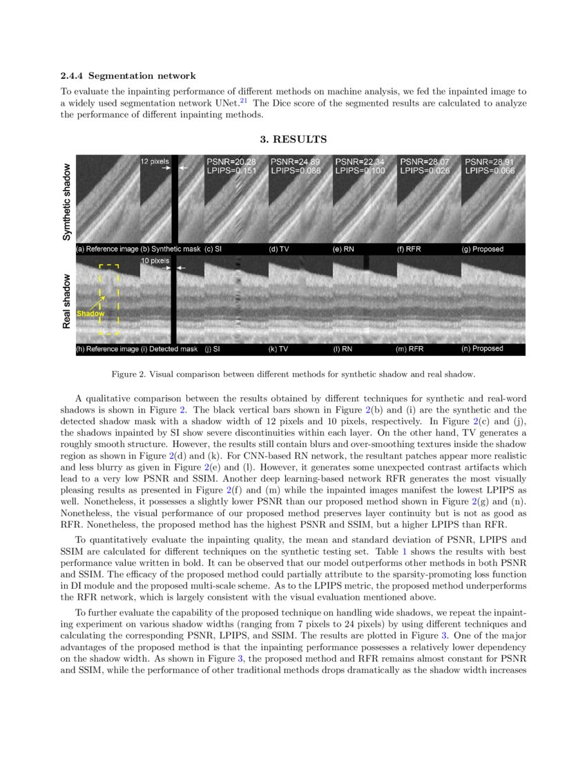 Multi-scale Sparse Representation-Based Shadow Inpainting for Retinal OCT Images | DeepAI