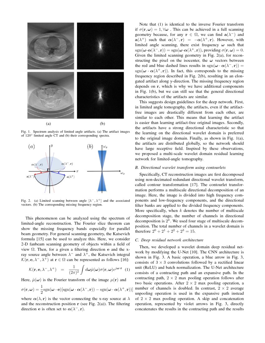 Multi-Scale Wavelet Domain Residual Learning for Limited-Angle CT ... Multi-Scale Wavelet Domain Residual Learning for Limited-Angle CT ...