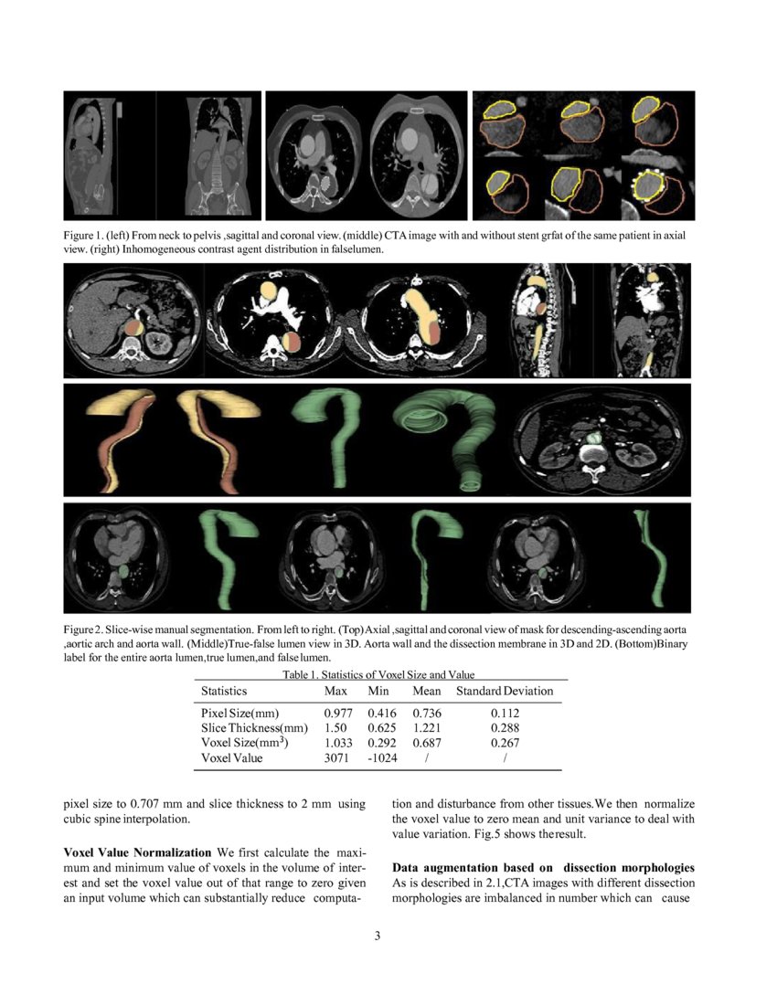 Multi-Task Deep Convolutional Neural Network for the Segmentation of Type B Aortic Dissection ...