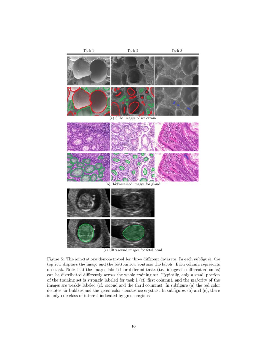 Multi Task Deep Learning For Image Segmentation Using Recursive