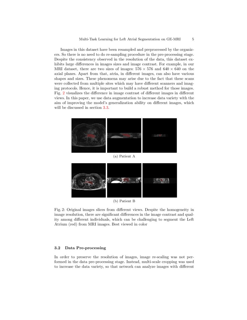 Multi-Task Learning for Left Atrial Segmentation on GE-MRI | DeepAI