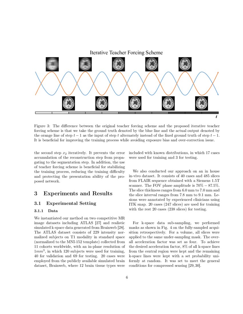 Multi-task MR Imaging with Iterative Teacher Forcing and Re-weighted ...